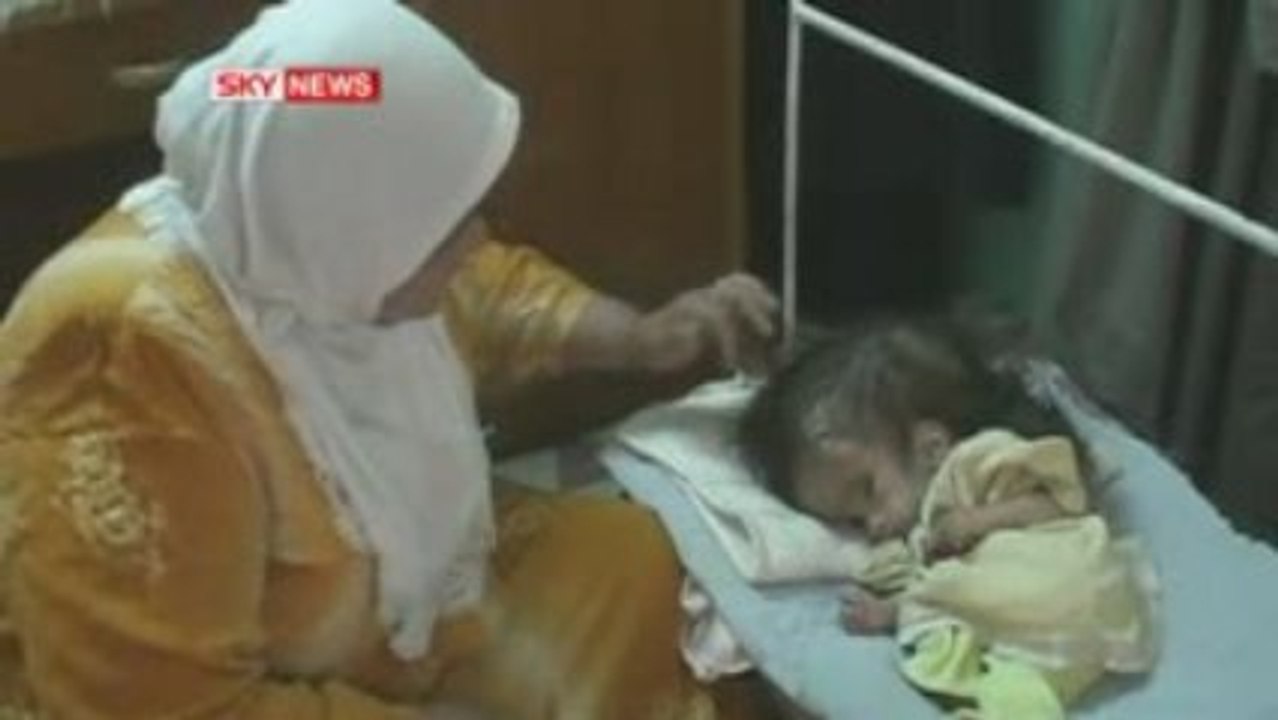 Fallujah depleted uranium deformed babies - Vidéo Dailymotion