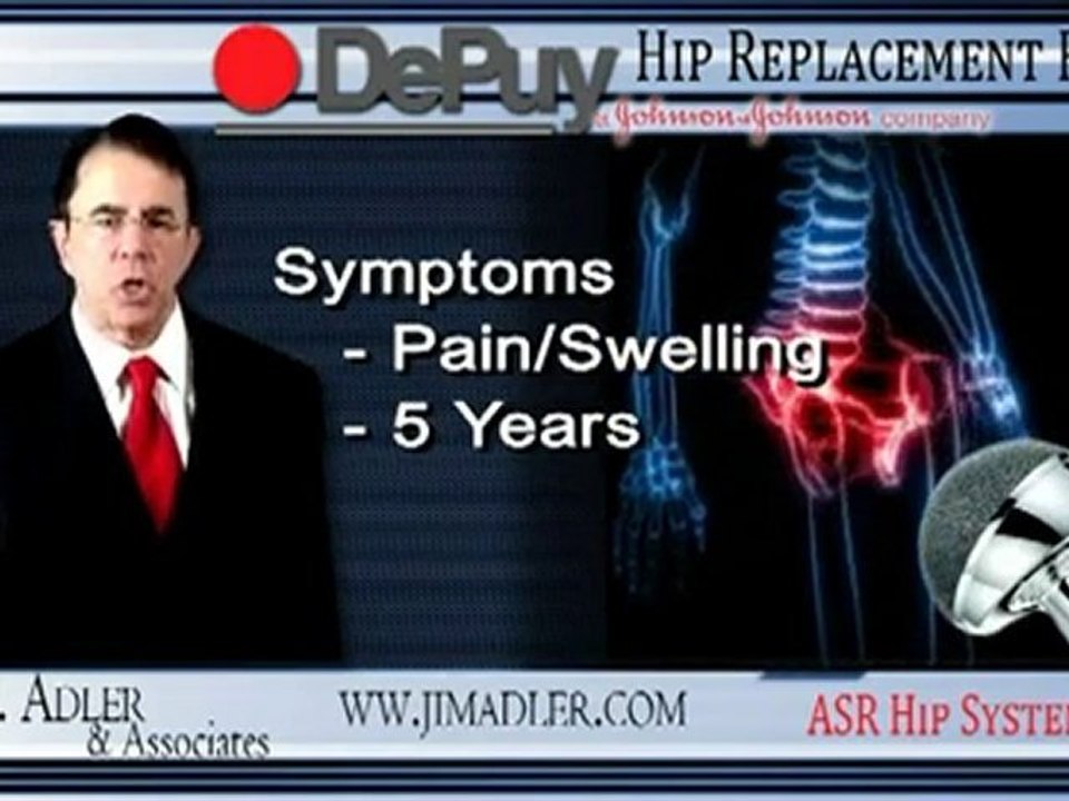 DePuy ASR Hip Replacement System Recall - video Dailymotion