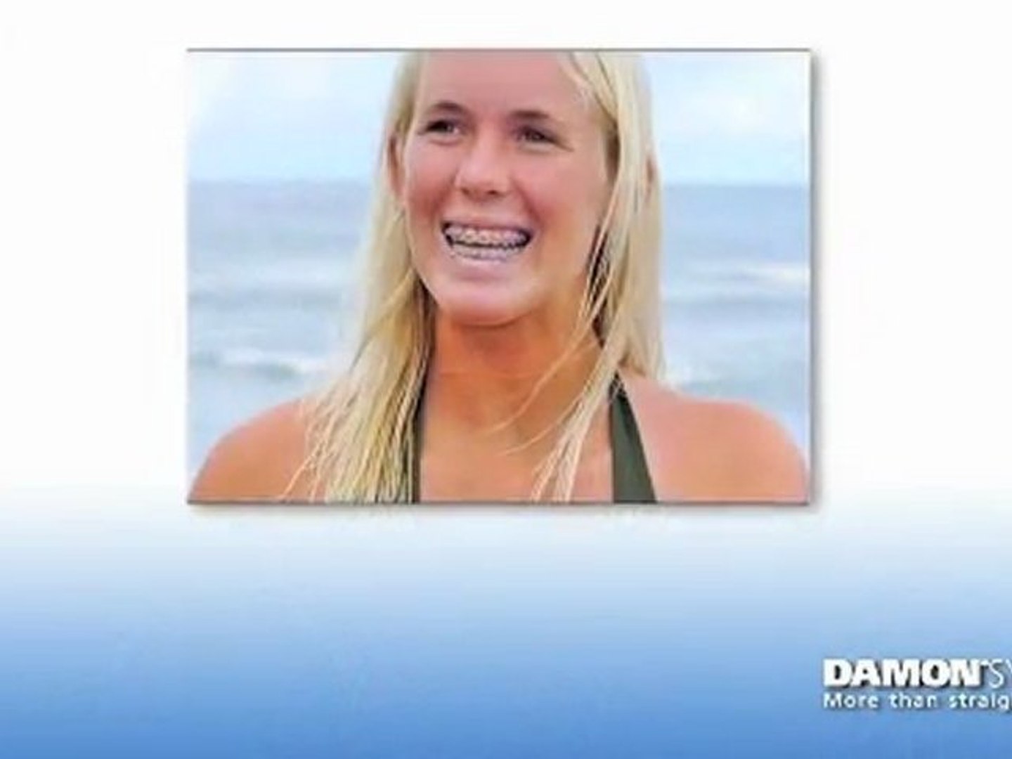 Bethany Hamilton After Surgery