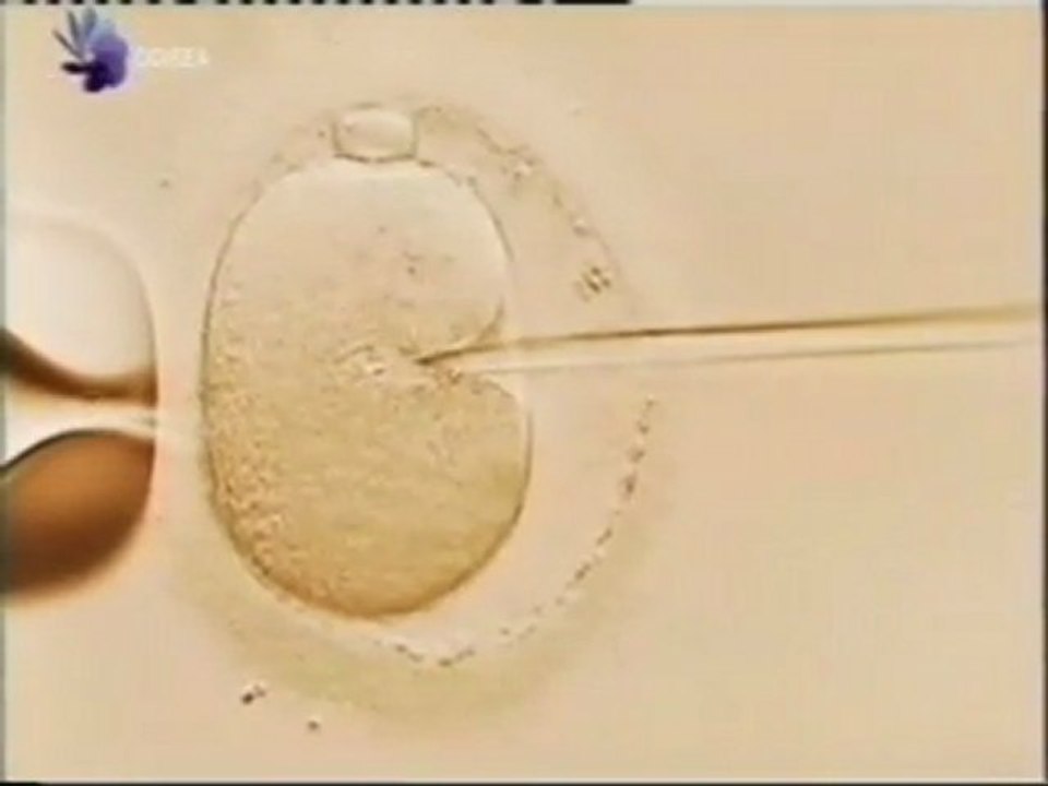 Ectogenesis: El utero artificial (Seleccion de embriones) - Vídeo ...