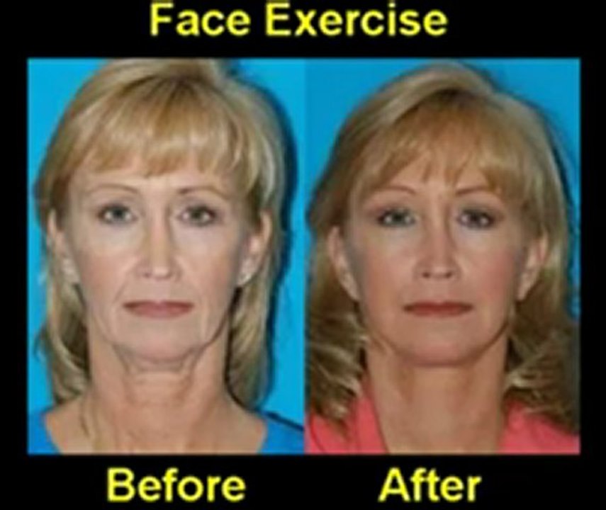 Face Exercise - Before and After Photos - video Dailymotion