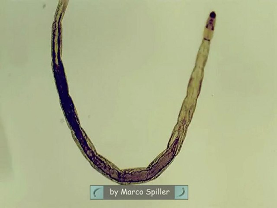 Ceratopogonidae larva - biting midges - Video Dailymotion