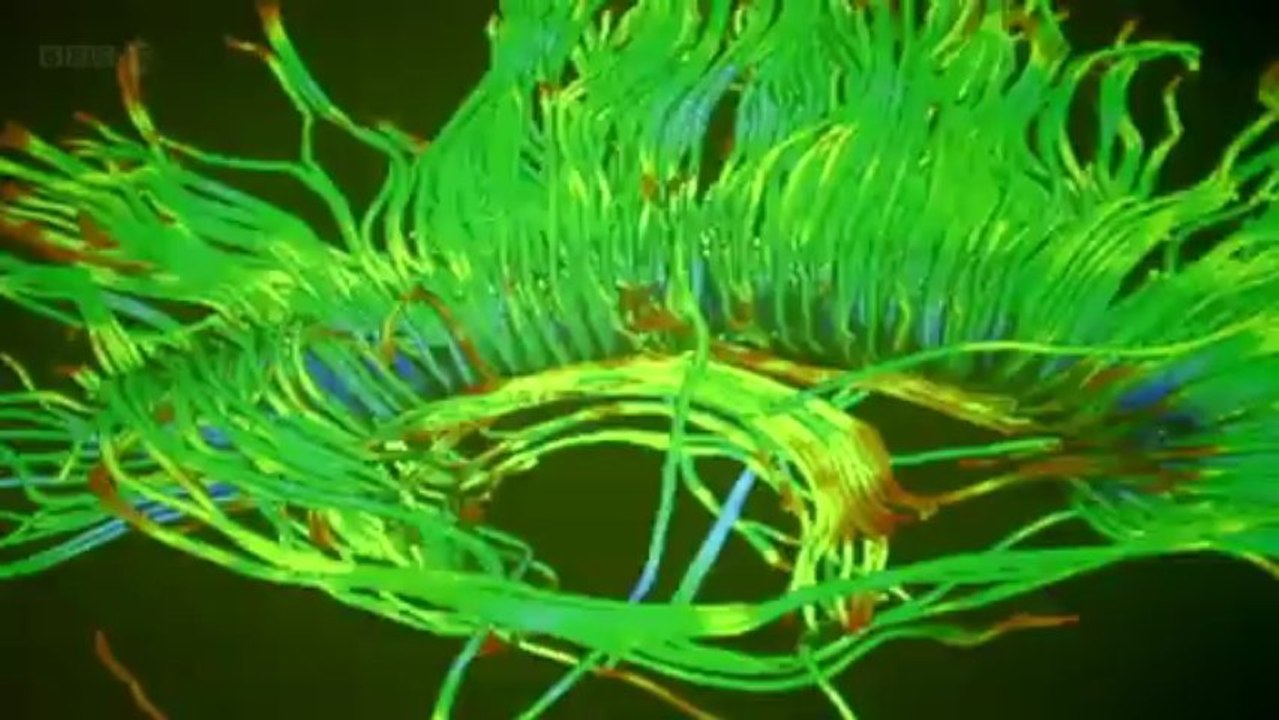 BBC HORIZON The Creative Brain. How Insight Works. - video Dailymotion