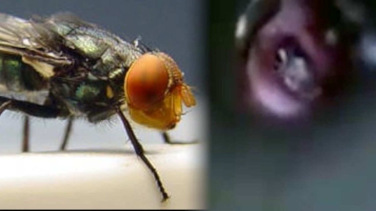 Flesh-Eating Maggots Found in Woman's HEAD - video Dailymotion