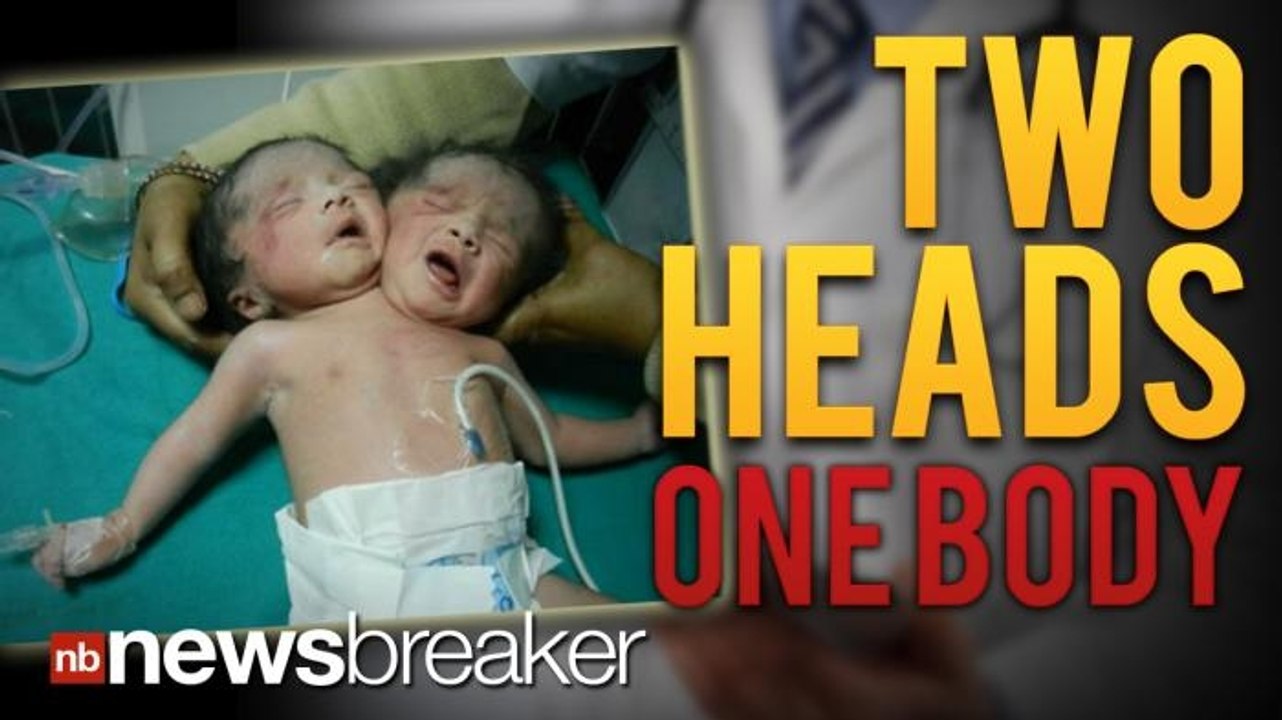 TWO HEADS: Rare Conjoined Twins Born in India Share One Body - video ...