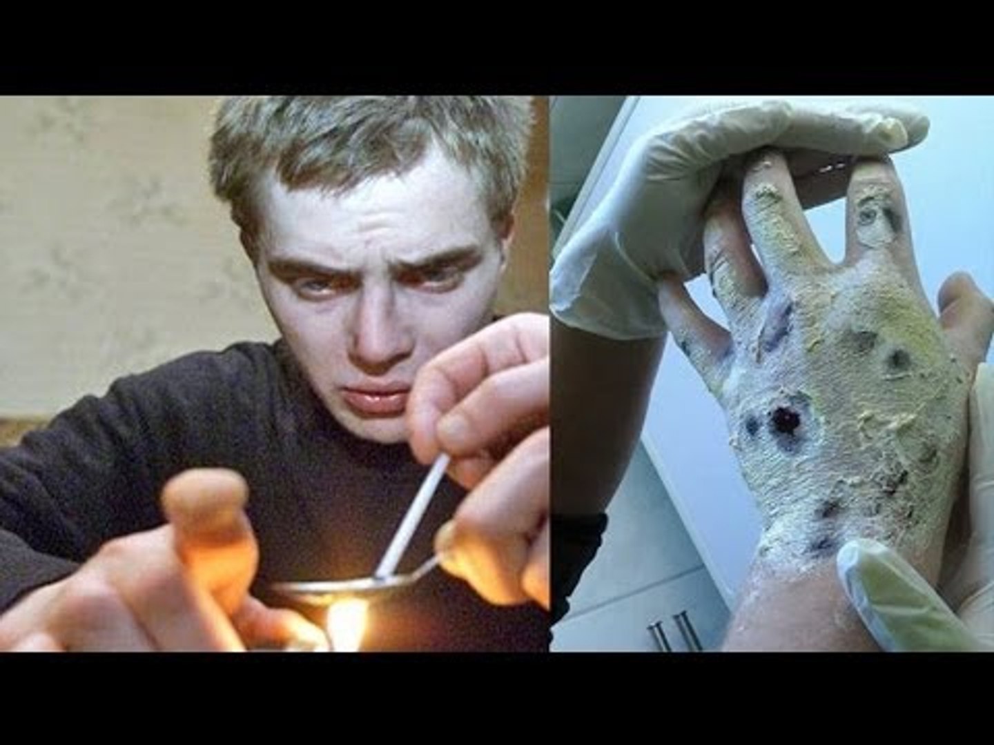 Crocodile Drug Skin Effects Crocodile Drug Skin Effects