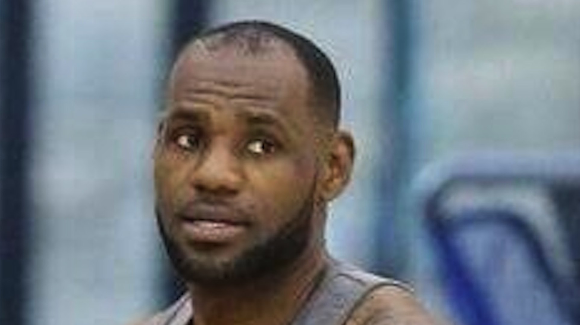 Lebron James Hairline Hair Transplant Before And After james before ...