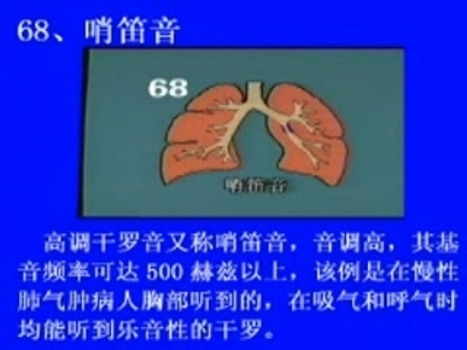 Sibilant rhonchi (high-pitched rhonchi) - video Dailymotion