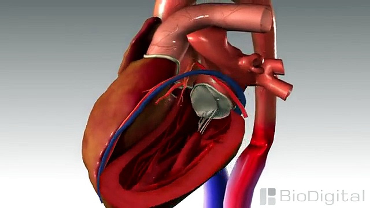 3D Medical Animation - Congestive Heart Failure - video Dailymotion