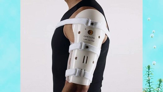 Corflex Long Sarmiento Brace Humerus Fracture Splint-S - video dailymotion