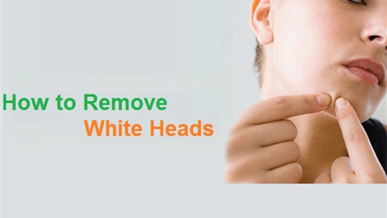 How to remove White Heads - video Dailymotion