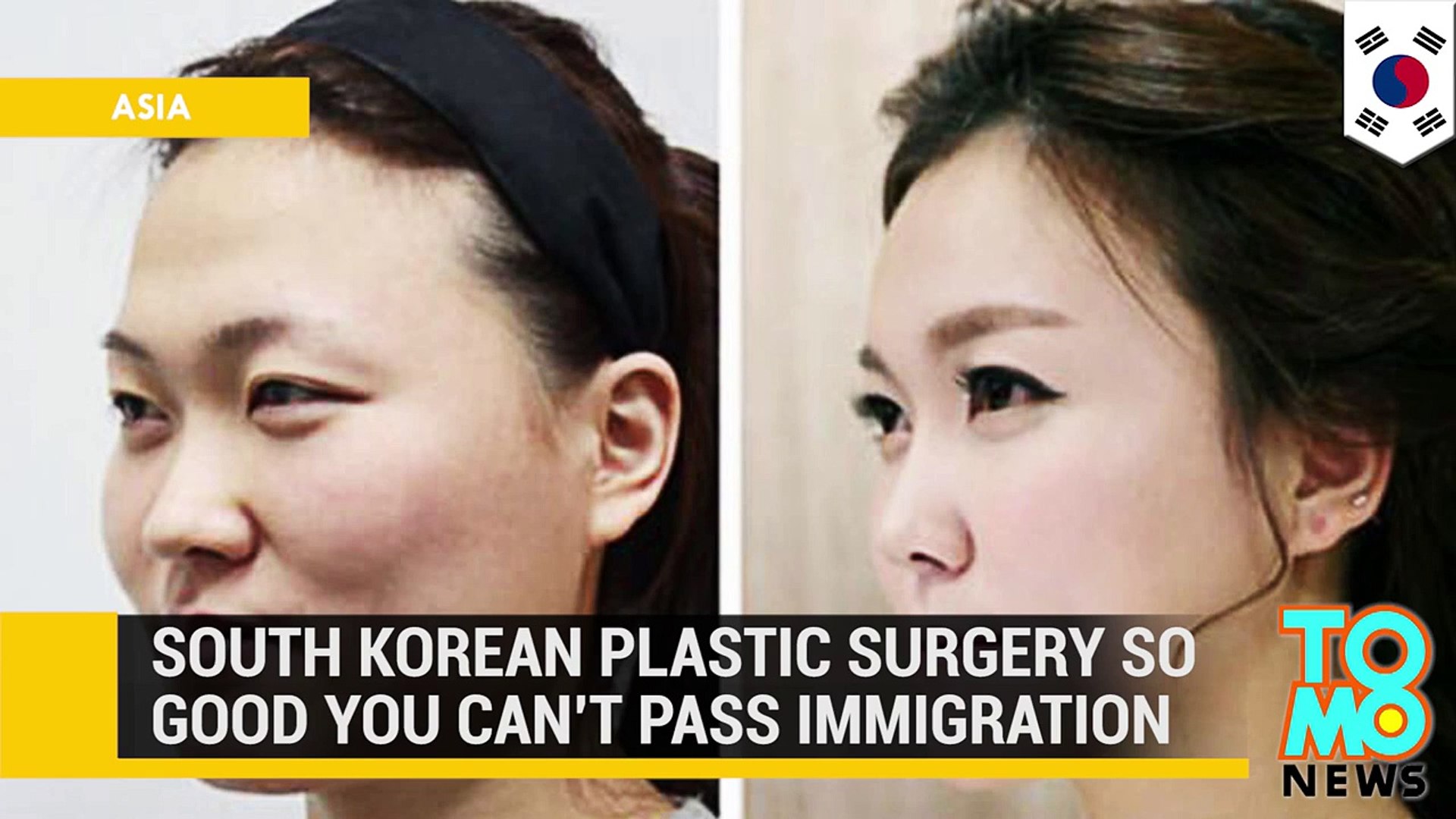 South Korean Plastic Surgery Gone Wrong