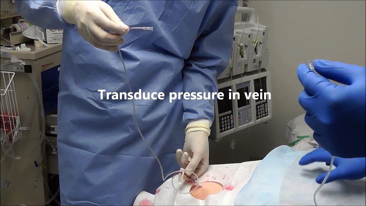 Pulmonary Artery (Swan Ganz) Catheter Insertion - video Dailymotion