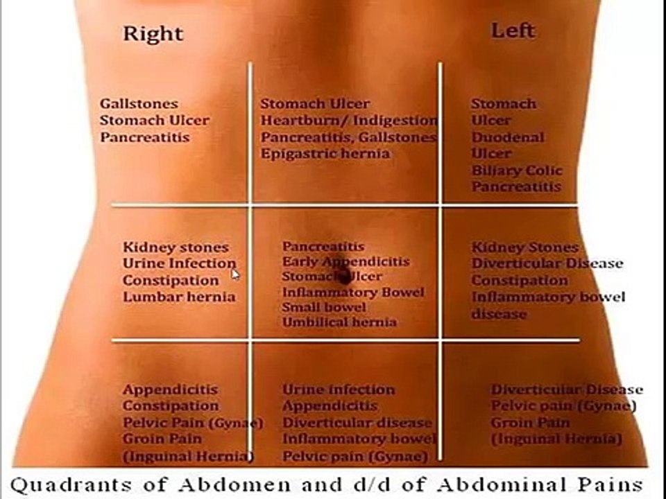 Differential diagnosis of abdominal pain according to abdominal regions ...