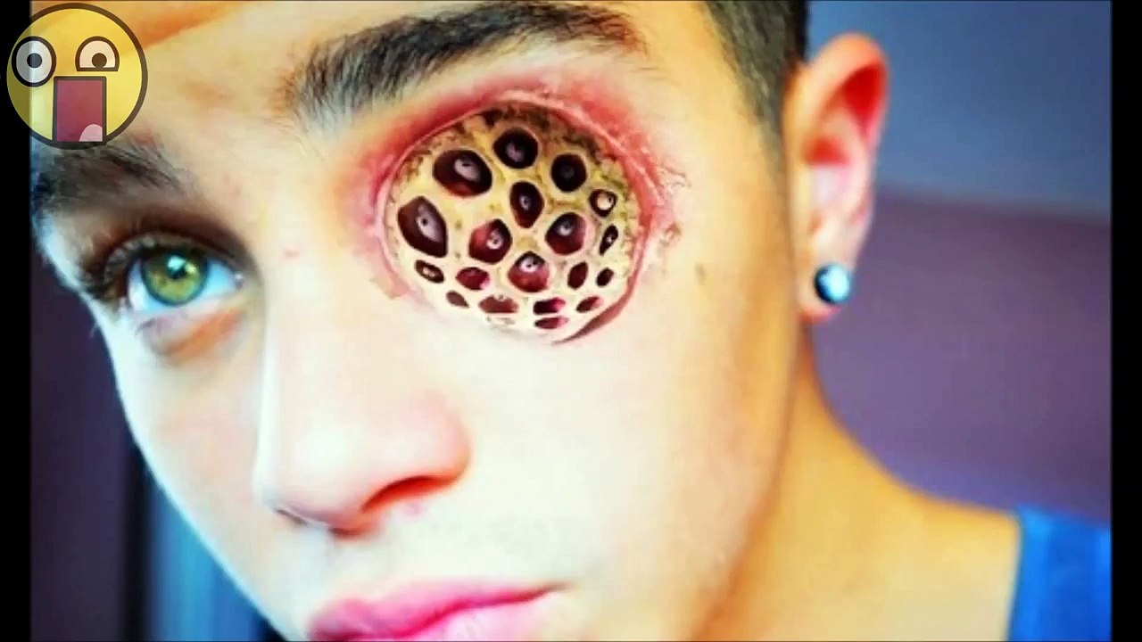 Best Trypophobia / Trypomania TEST - video Dailymotion