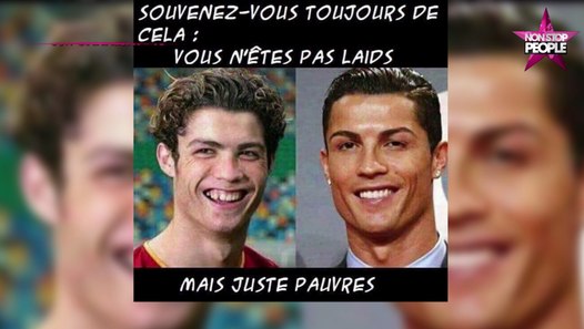 Cristiano Ronaldo A T Il Fait De La Chirurgie Esthétique La Photo Qui