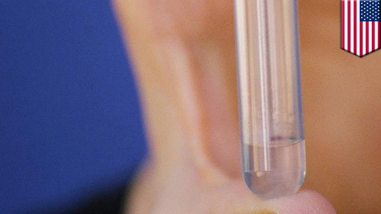 Male birth control: Contraceptive Vasalgel provides new birth control ...