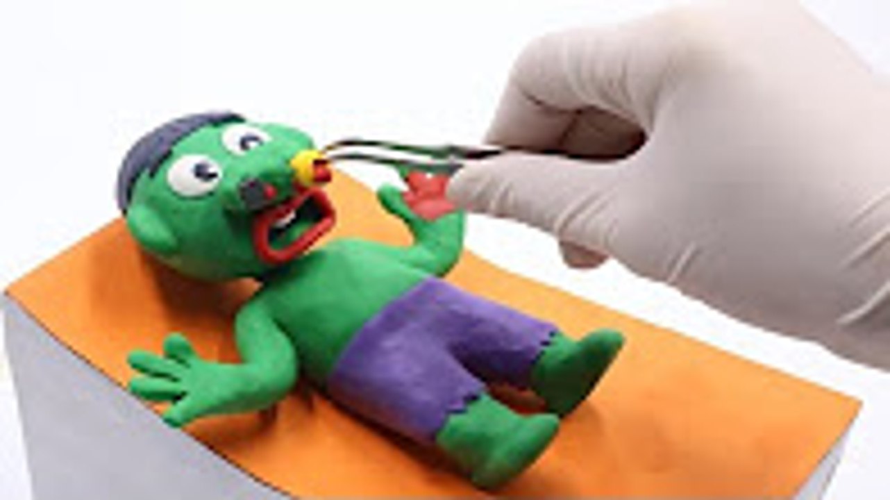 Baby Hulk vs Elsa Ears and Noses Animation Superhero In Real Life Stop ...