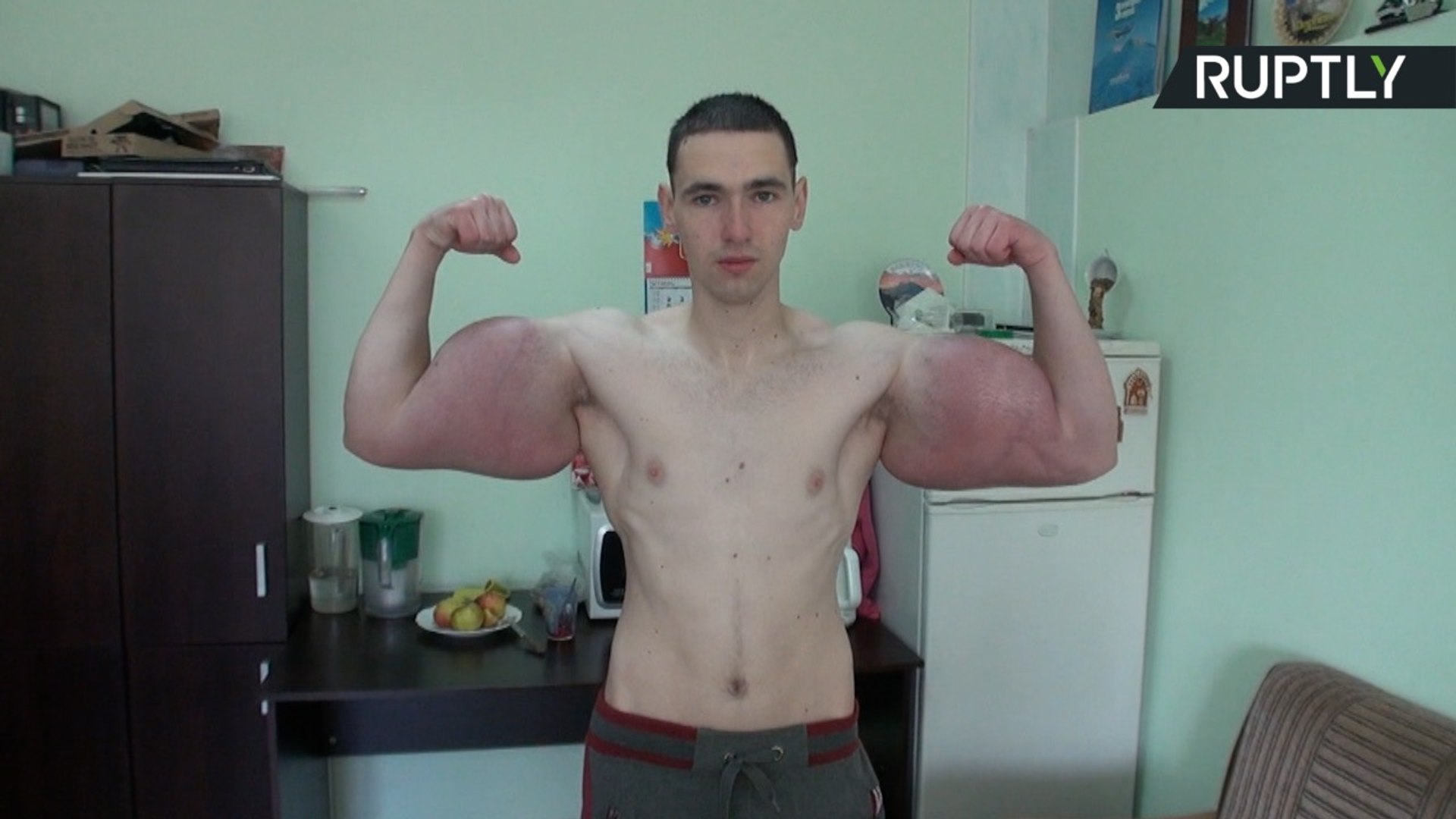 Synthol Before After