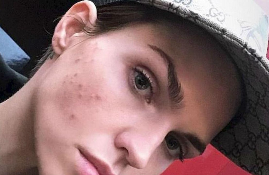 Ruby Rose's germ-infested phone gives her acne - video Dailymotion