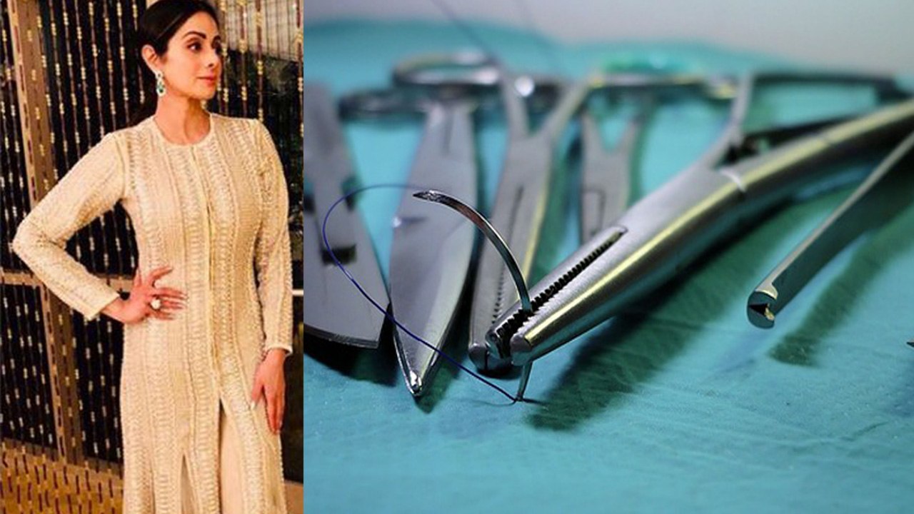 Sridevi : Did the actress passed away due to too many plastic surgery ...