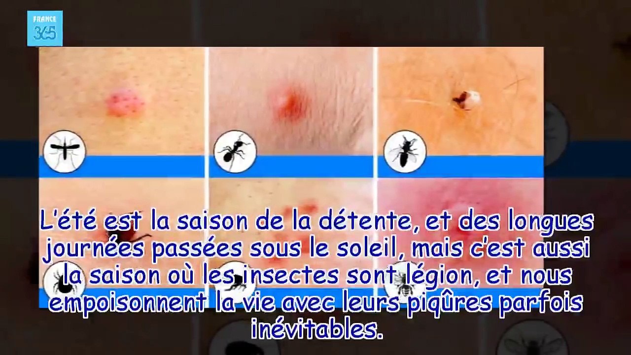 12 piqûres d’insectes communes et comment reconnaître chacune d’elles ...