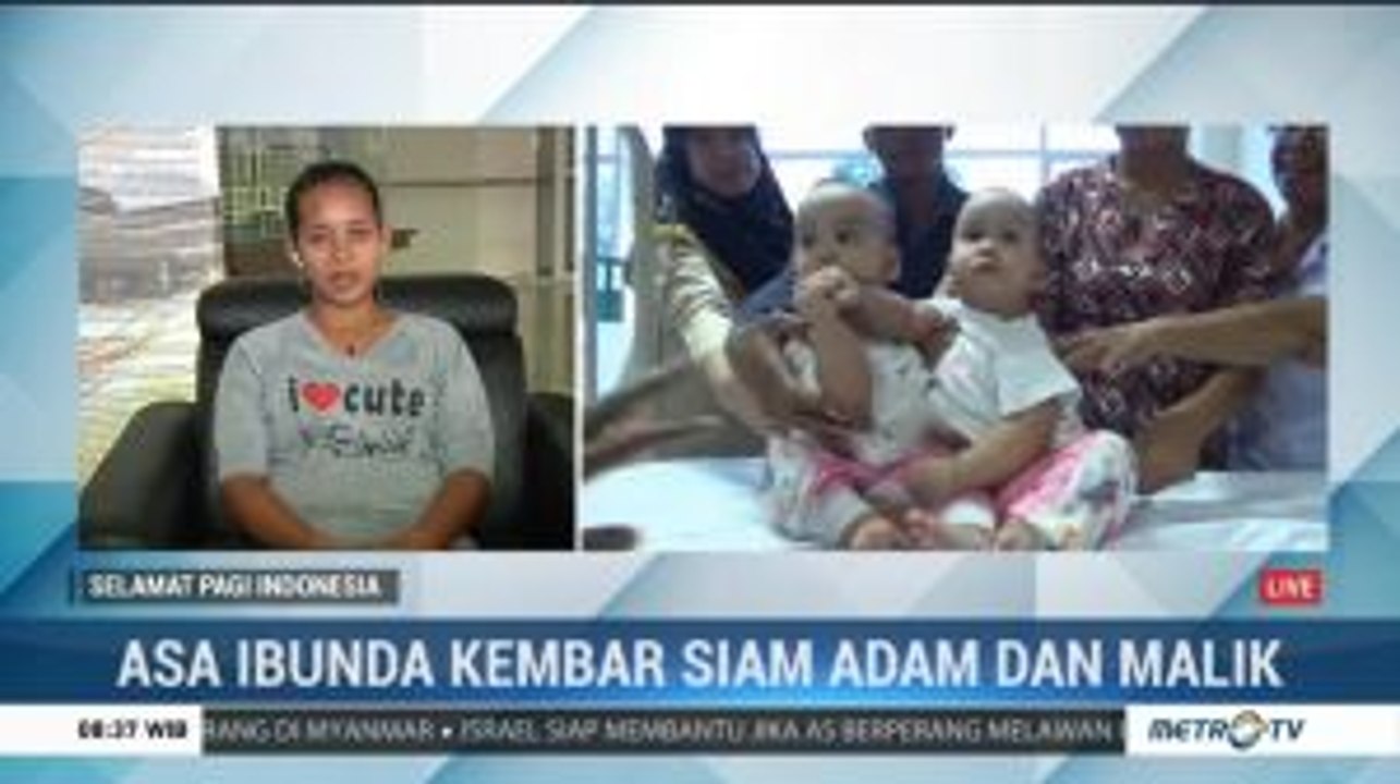 Kondisi Terkini Kembar Siam Adam dan Malik - Video Dailymotion