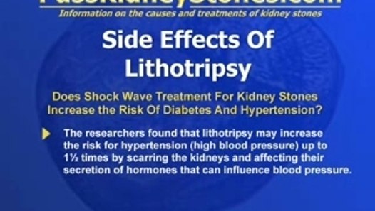 Side Effects From Lithotripsy - video dailymotion