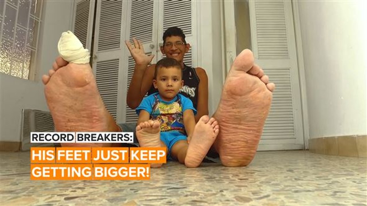 He's got the biggest feet in the world & they're still growing! - video ...