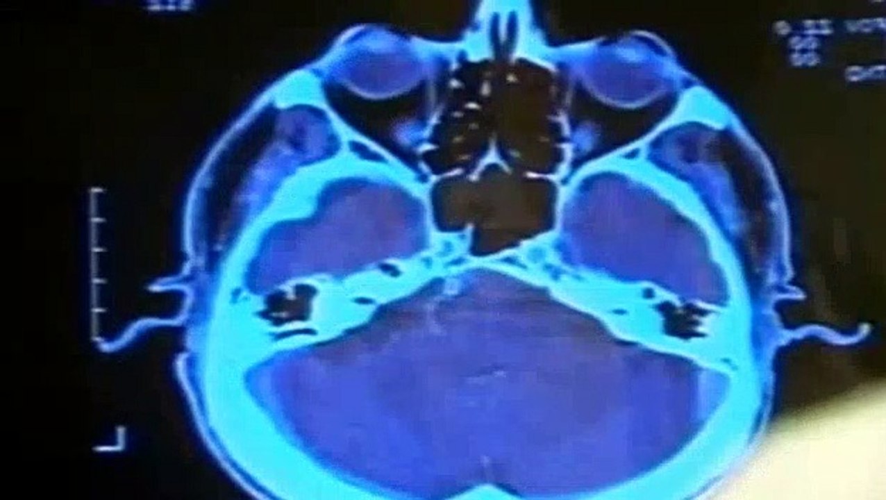 Forensic Files - S03E04 - Foreign Body - video Dailymotion