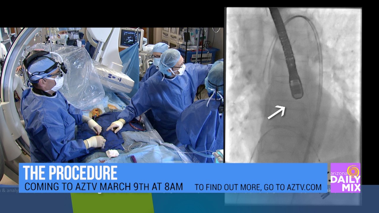 The Procedure on AZTV with David G. Rizik, MD (Part 3) - video Dailymotion