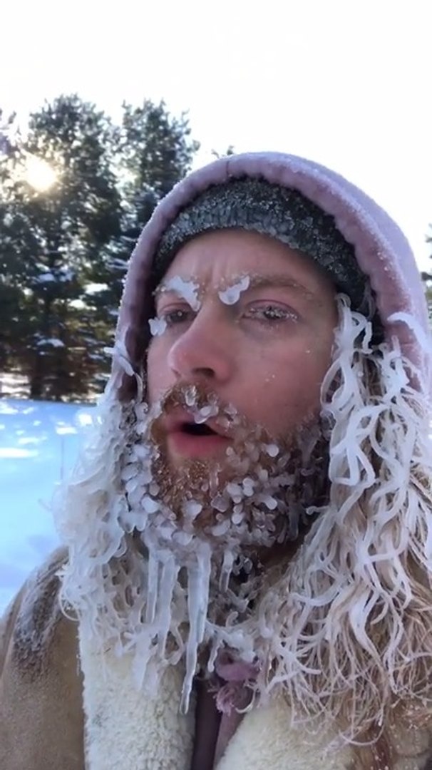 Frozen Face
