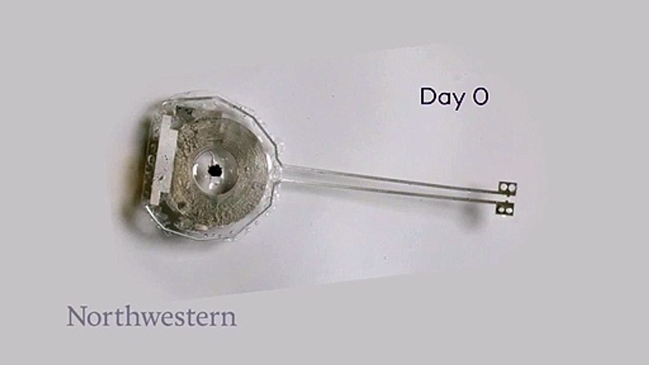 First-ever transient pacemaker harmless dissolves in the body - Vídeo ...