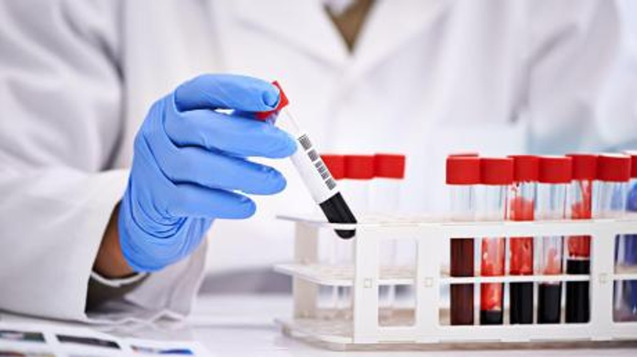 TCK : définition, rôle, comment analyser les résultats ? - Vidéo ...