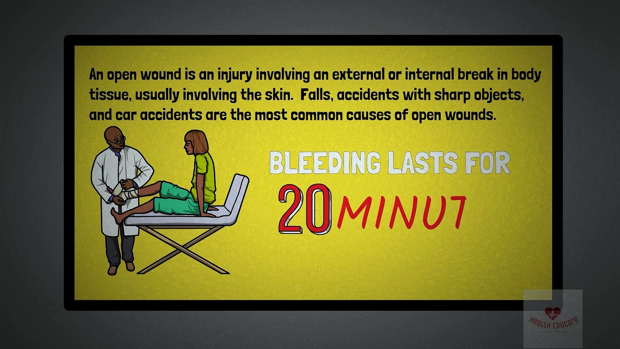 Types of Open Wounds (Abrasion, Laceration, Skin Avulsion, Puntured ...
