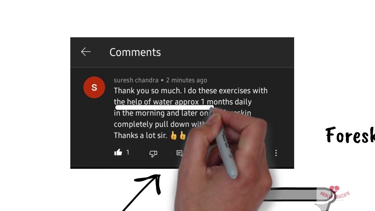 Do Foreskin stretching exercise work? Find Out!!! - video Dailymotion