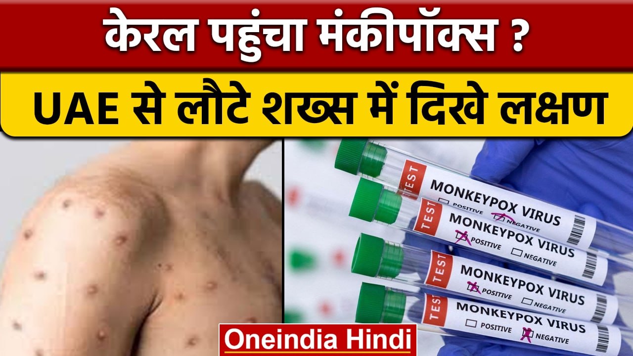 Kerala के एक शख्स में मिले Monkeypox के लक्षण, अभी UAE से लौटा था ये ...