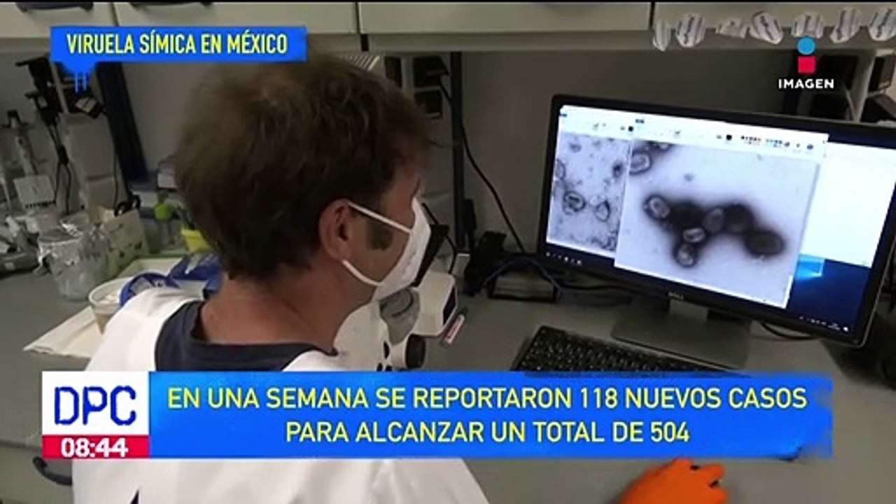 Contagios De Viruela Del Mono En México Siguen En Aumento Vídeo