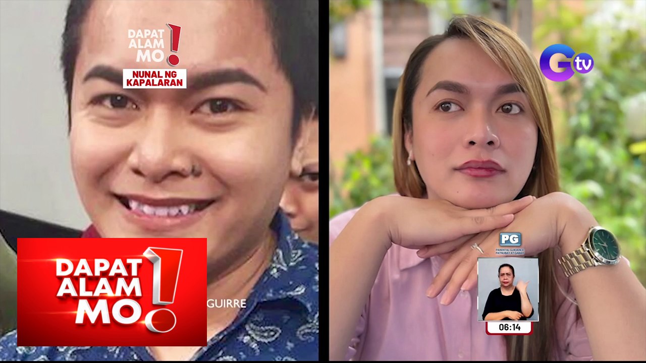 Lumalaking nunal, matatanggal nga ba gamit ang remover cream? | Dapat ...