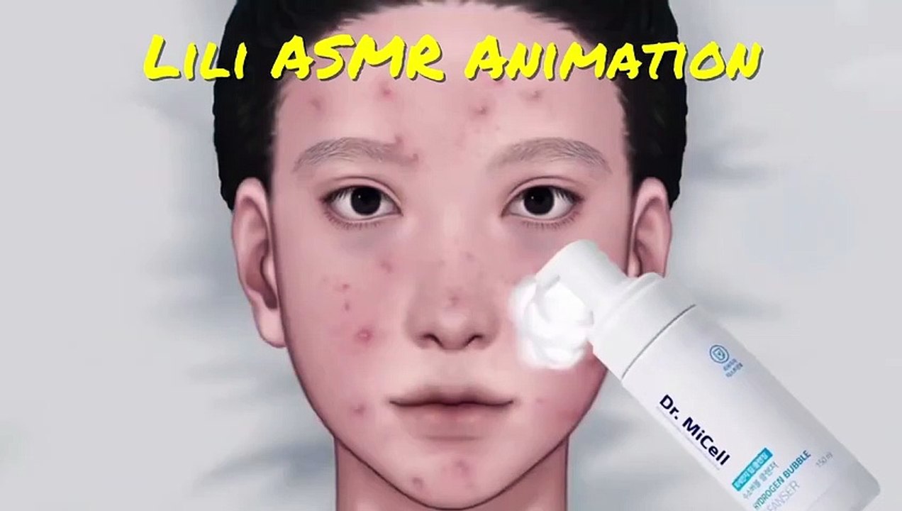 ASMR [MMD]Animation of how acne treatment was done Lili ASMR Animation ...