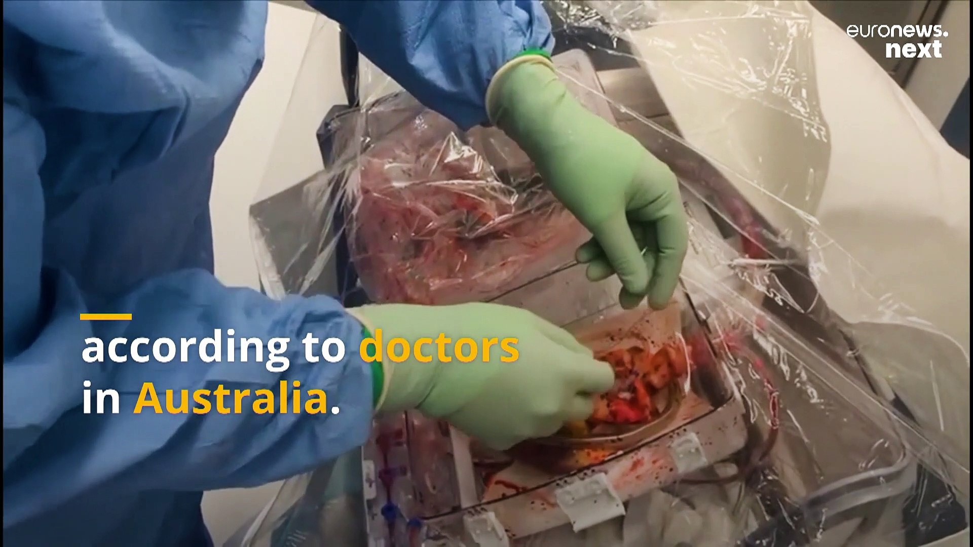 ‘Heart in a box’: This device revives hearts that stopped beating to ...