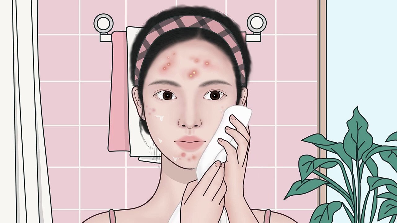 ASMR Acne Treatment At Home _ Pimple, Acne Removal Animation / Animesh ...