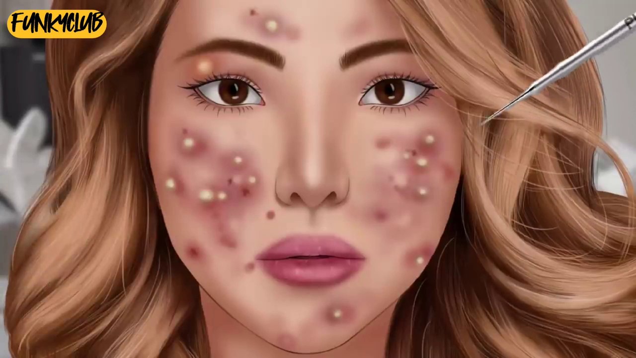 [ASMR] eye treatment animation | eye pimple | Acne Removal - video ...