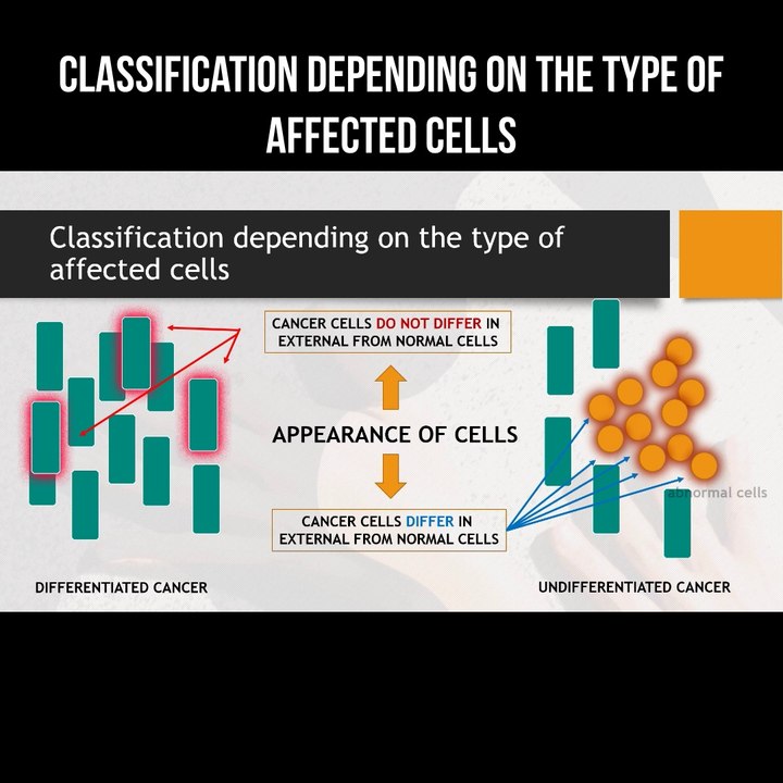 Classification of the cancer depending on the type of affected cells ...