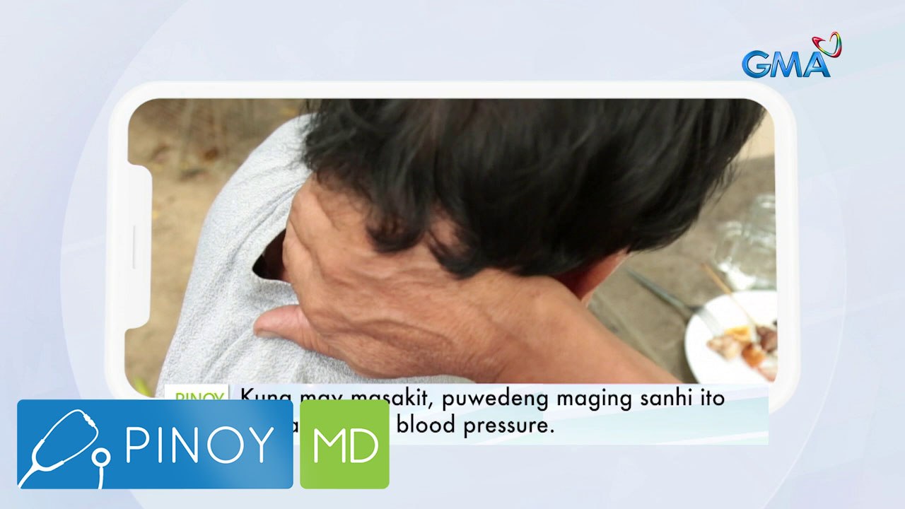 Pananakit ng batok, sintomas ba ng altapresyon? | Pinoy MD - video ...