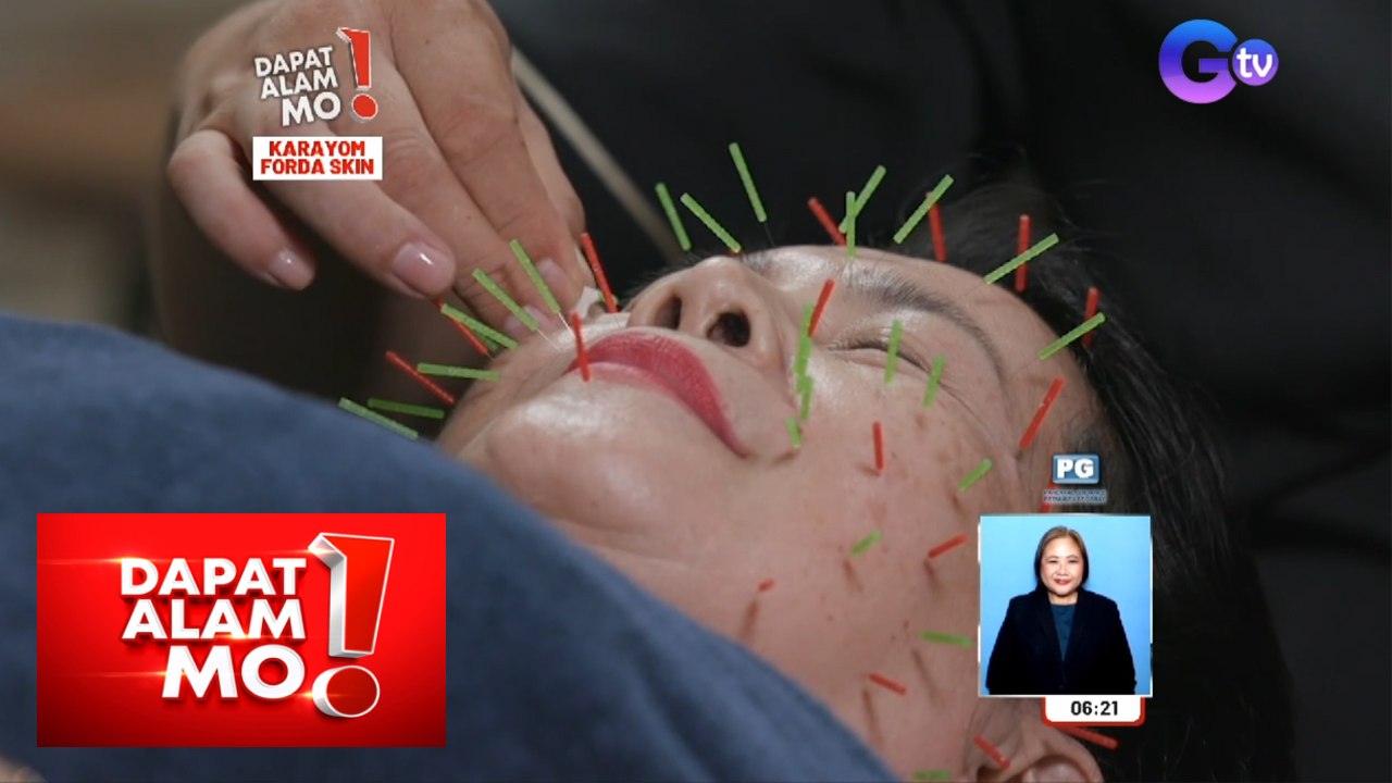 Acupuncture sa mukha, sagot sa wrinkles at fine lines?! | Dapat Alam Mo! - video Dailymotion