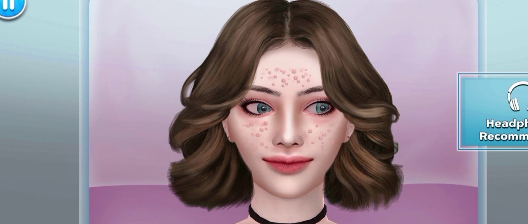 ASMR Blackhead removal treatment animation for young girl||ASMR acne ...