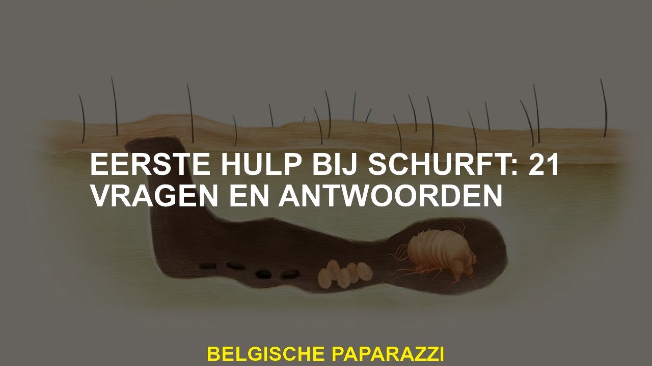 Eerste hulp voor schurft: 21 vragen en antwoorden - Vidéo Dailymotion