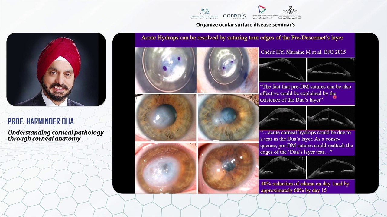 Prof. Harminder Dua:Understanding corneal parthology through corneal ...