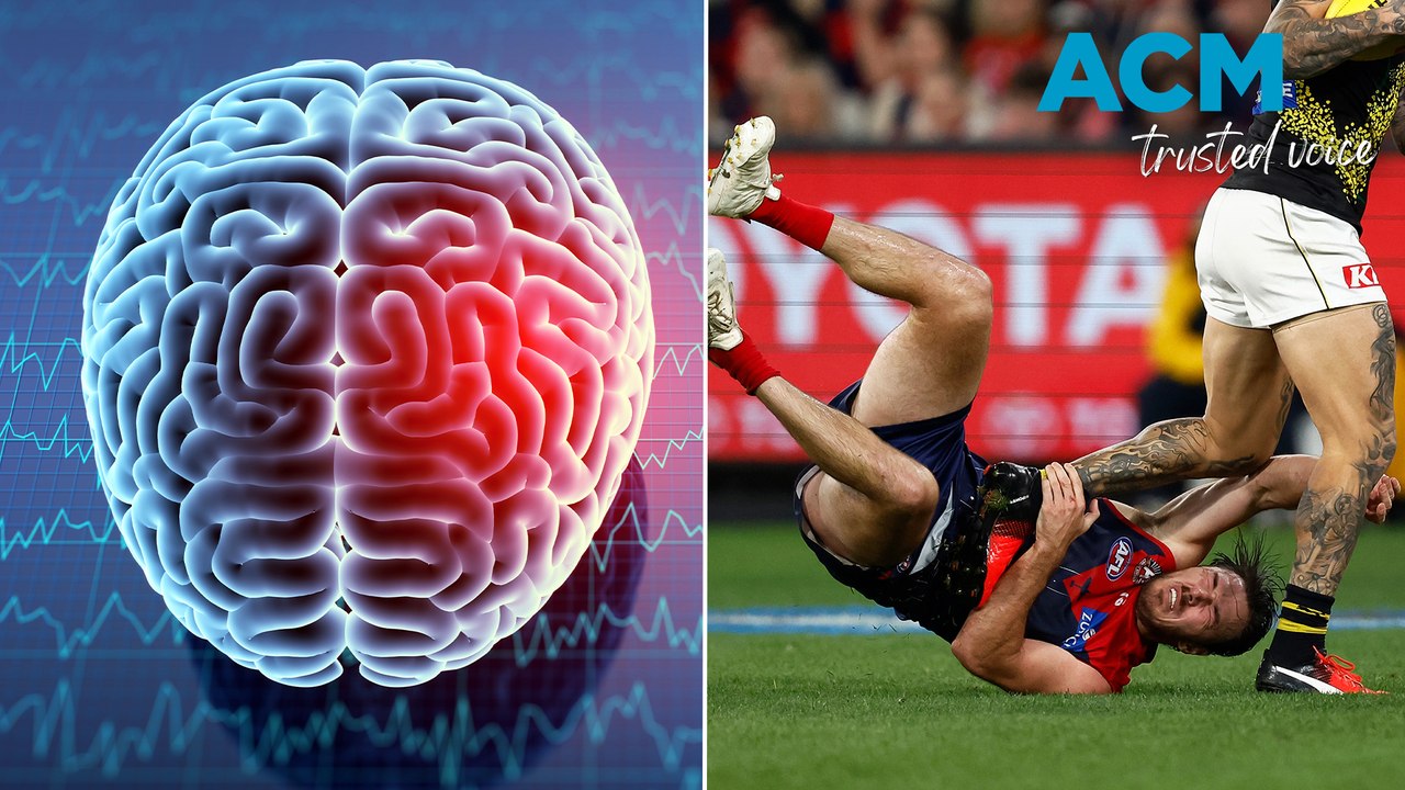 The truth about concussions in sport - video Dailymotion